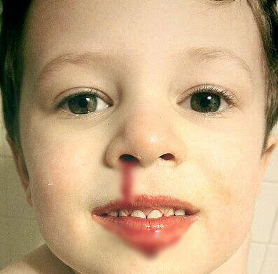 Croup Cough: Understanding and Managing It in Children - Baby Kids Health